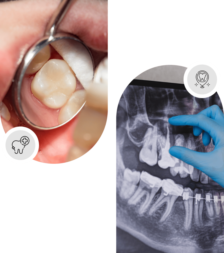 Dental Fillings in Cambridge, ON | Durable, Aesthetic Restorations